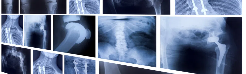 The Evolution of Radiation Safety: A History of X-Ray Badges